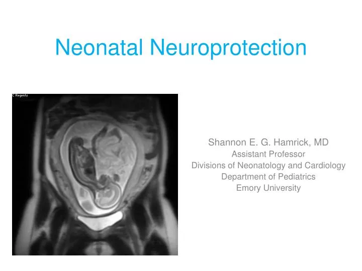 PPT - Neonatal Neuroprotection PowerPoint Presentation, free download ...