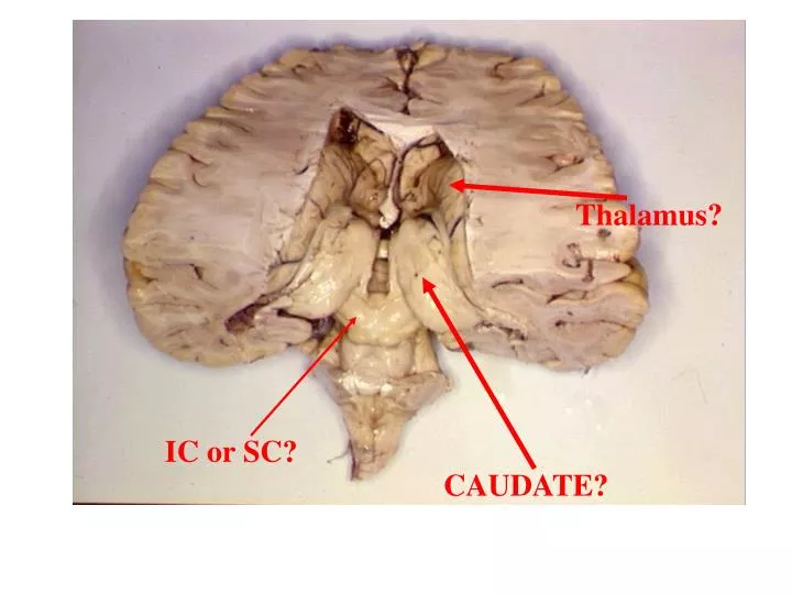 PPT - CAUDATE? PowerPoint Presentation, free download - ID:1370735