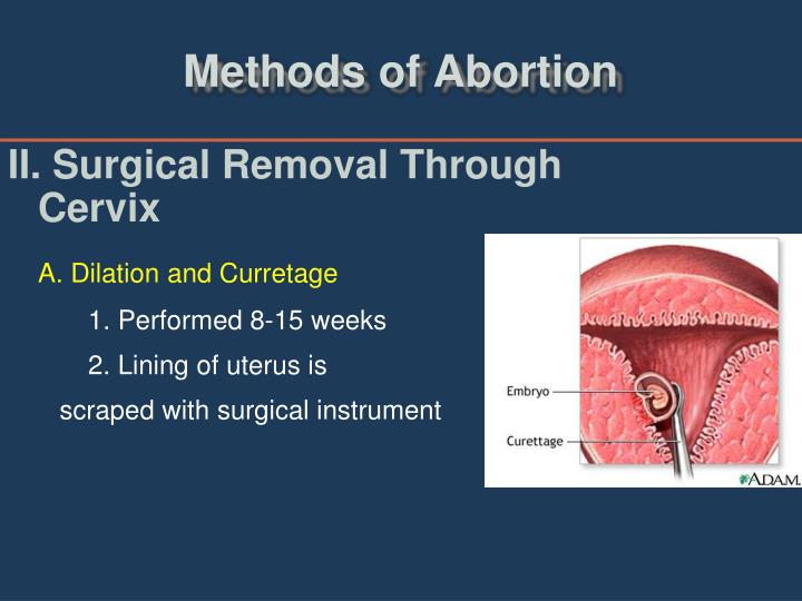 PPT - An Overview of Abortion PowerPoint Presentation - ID:1371179