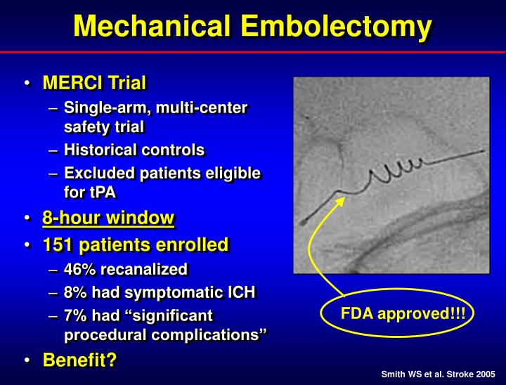PPT - Acute Stroke Management: Update PowerPoint Presentation - ID:1371659