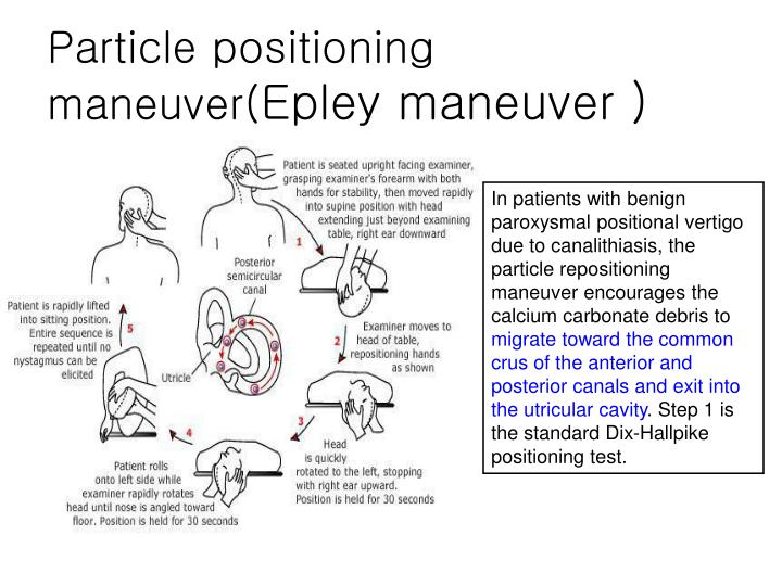 Seated Canalith Repositioning Technique