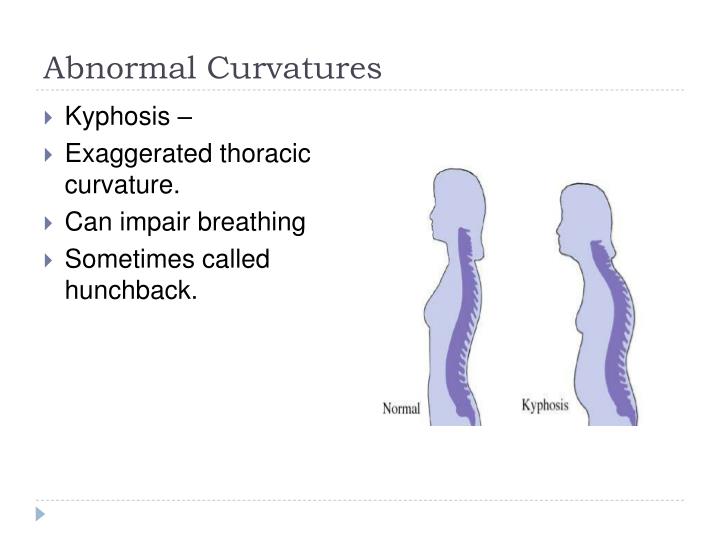 PPT - Skeletal System Chapter 8/Part II PowerPoint Presentation - ID ...