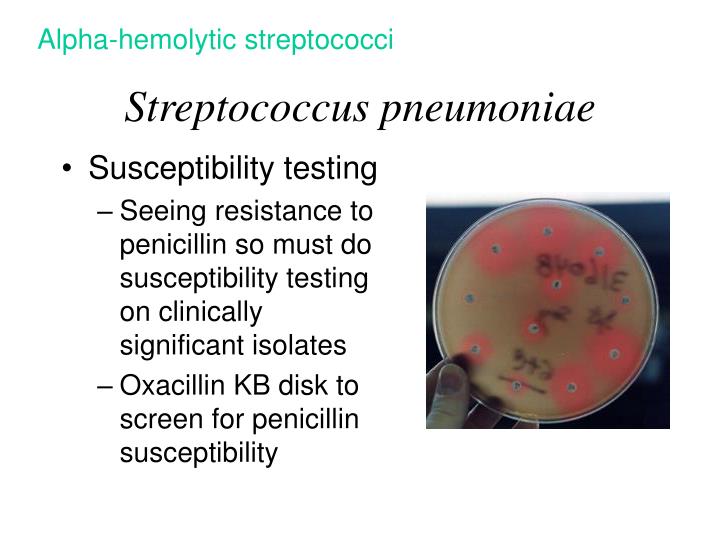 PPT - Streptococcaceae I PowerPoint Presentation - ID:1377755