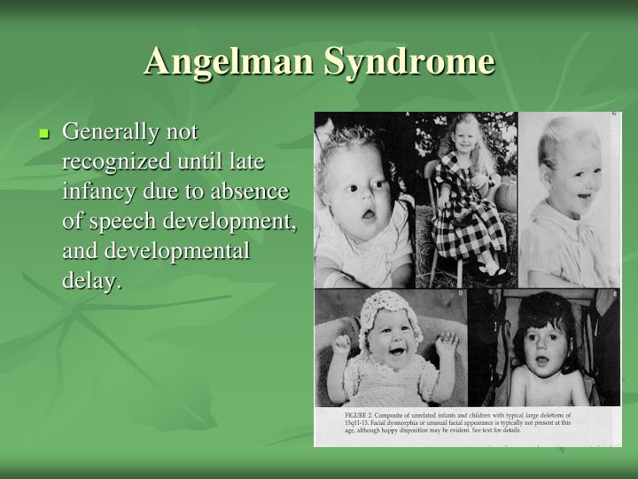 PPT - Angelman Syndrome, Rett Syndrome, and Tuberous Sclerosis ...