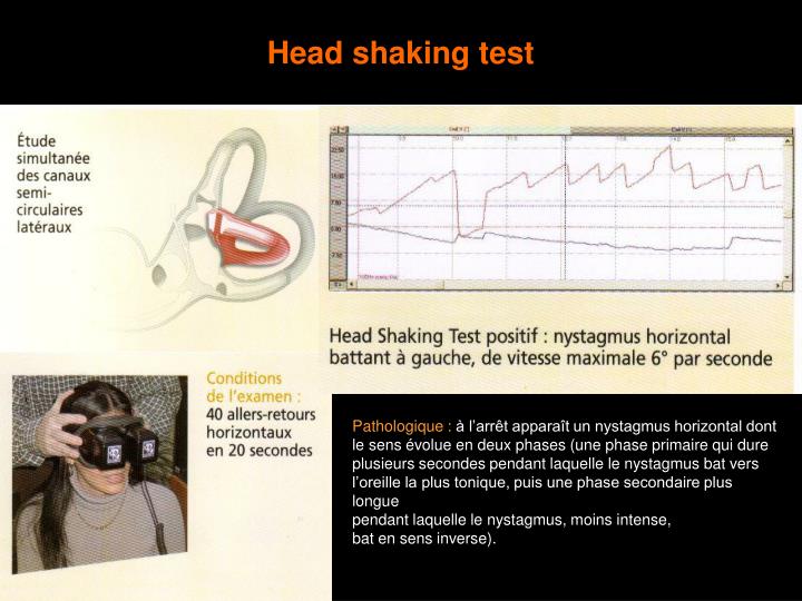 PPT - EXPLORATIONS COCHLEO-VESTIBULAIRES PowerPoint Presentation - ID ...
