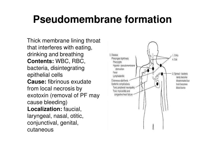 PPT - Corynebacterium diphtheriae PowerPoint Presentation - ID:1380889