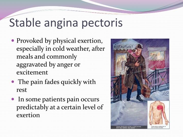 PPT - Angina pectoris PowerPoint Presentation - ID:1382313