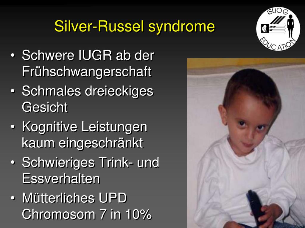 PPT - Fetal Syndromes in Prenatal Diagnosis - Challenges and Markers ...