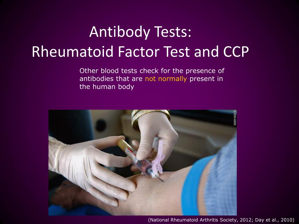 PPT - Arthritis: RA, OA, & SLE Treatments PowerPoint Presentation, free ...