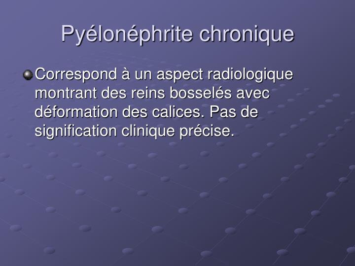 PPT - Infections génito-urinaires PowerPoint Presentation - ID:1386281