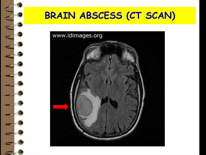PPT - THERAPY OF ANAEROBIC INFECTIONS PowerPoint Presentation - ID:138850