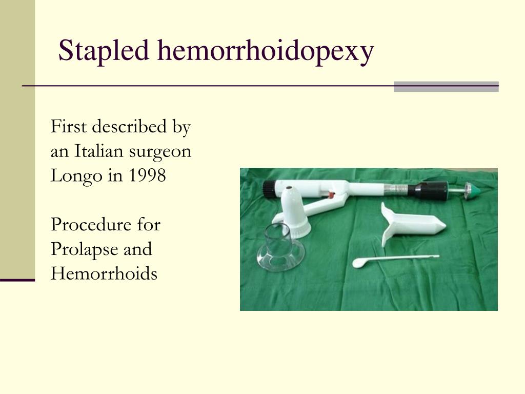 Ppt Updates On The Treatment Of Hemorrhoidal Disease Powerpoint