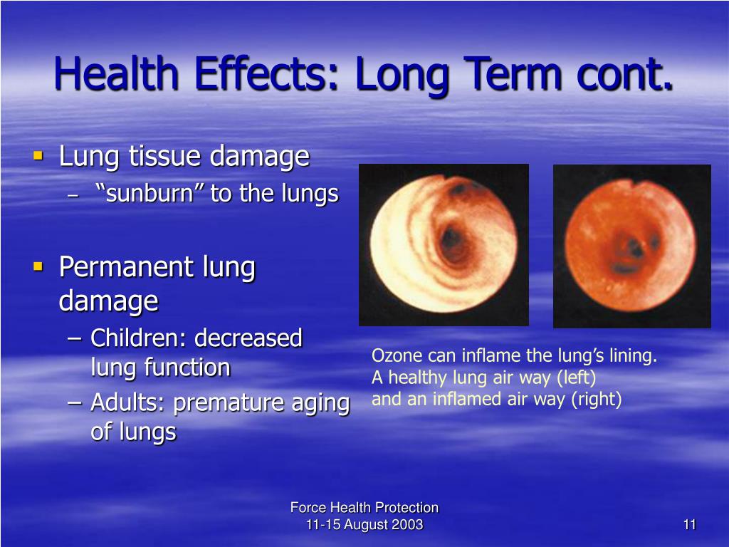 PPT - Environmental and Health Impacts of Air Pollution: Ozone ...