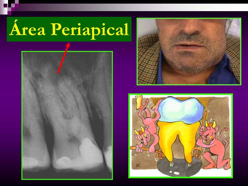 PPT - UNIVERSIDAD DE SAN CARLOS DE GUATEMALA PowerPoint Presentation ...