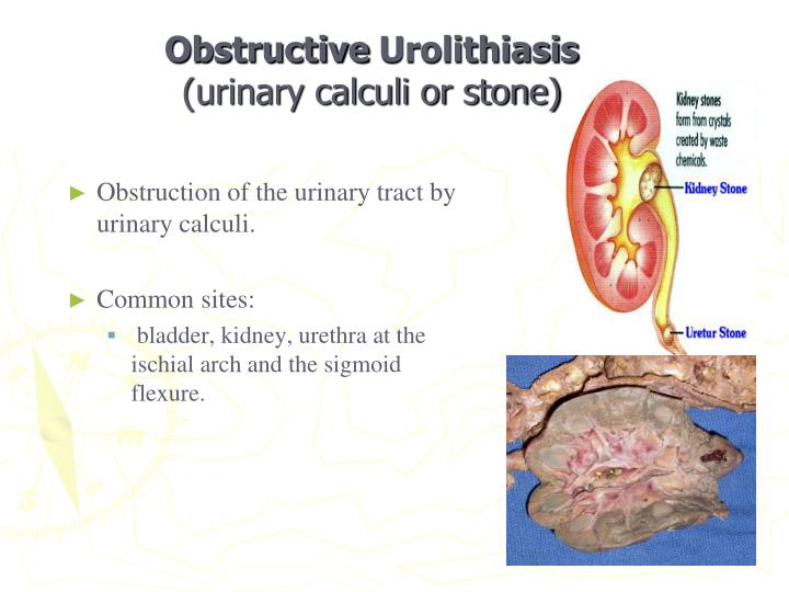 PPT - Disorders of Urinary System PowerPoint Presentation - ID:1397046