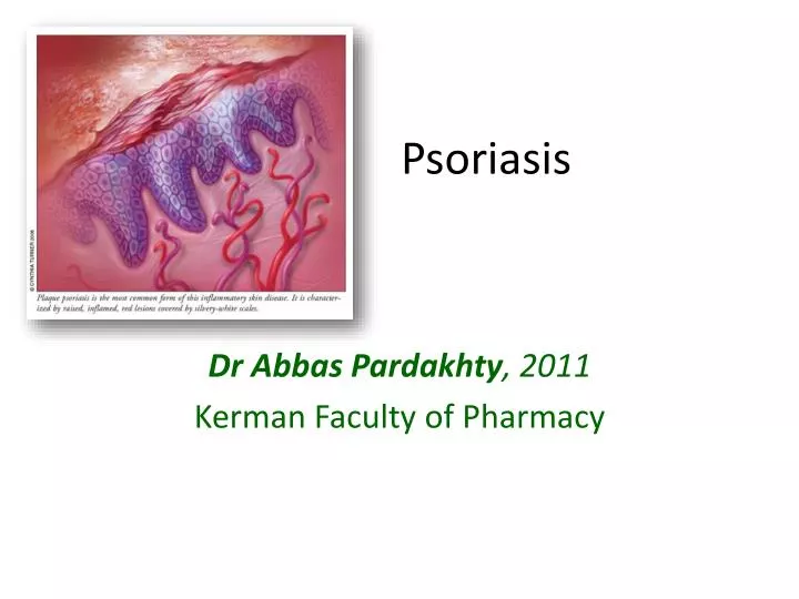 PPT - Psoriasis PowerPoint Presentation, free download - ID:1402286