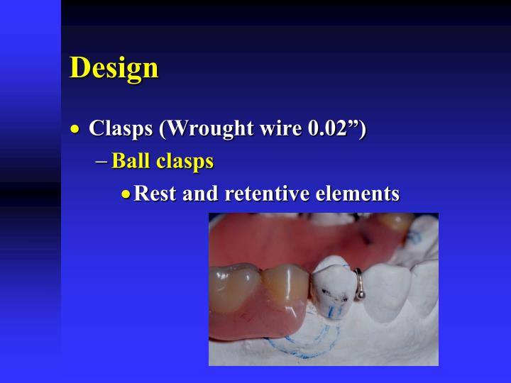 PPT - Interim Removable Partial Dentures PowerPoint Presentation - ID ...