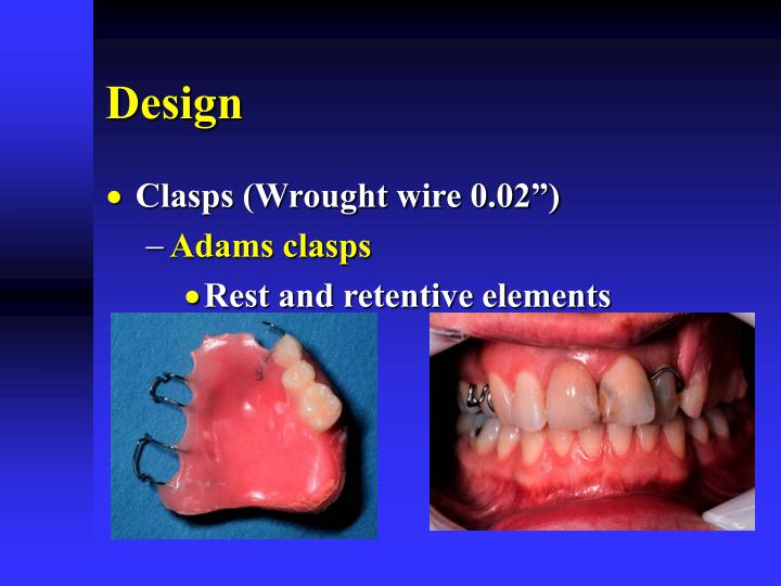 PPT - Interim Removable Partial Dentures PowerPoint Presentation - ID ...