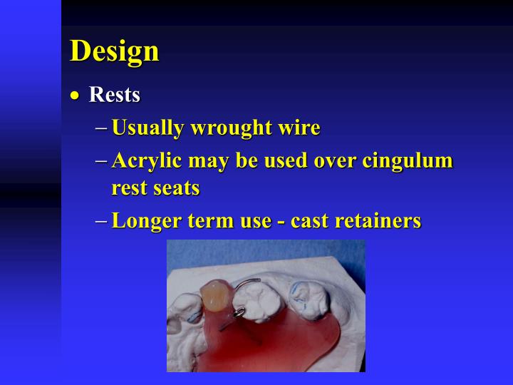 PPT - Interim Removable Partial Dentures PowerPoint Presentation - ID ...