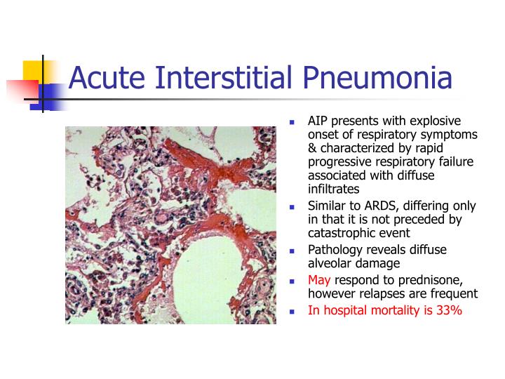 PPT - Interstitial Lung Disease PowerPoint Presentation - ID:1407927