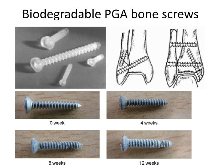 PPT - Orthopedic Implants PowerPoint Presentation - ID:1409228
