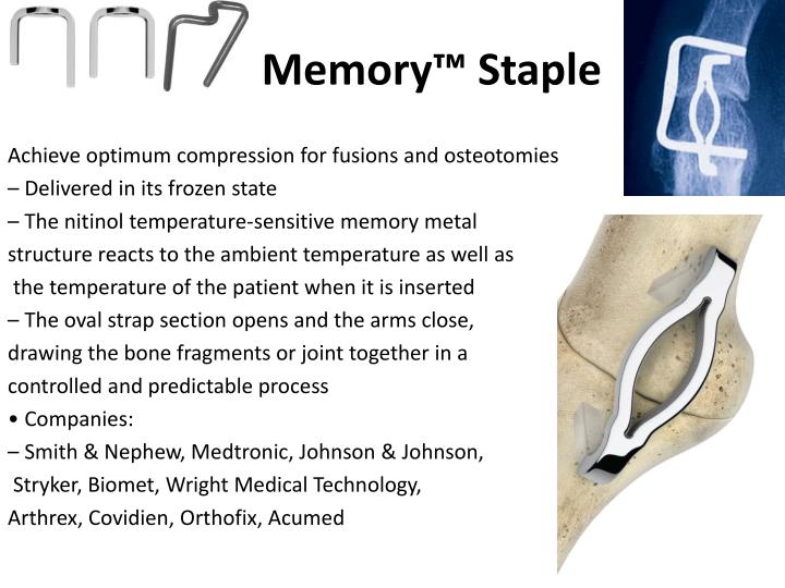 PPT - Orthopedic Implants PowerPoint Presentation - ID:1409228