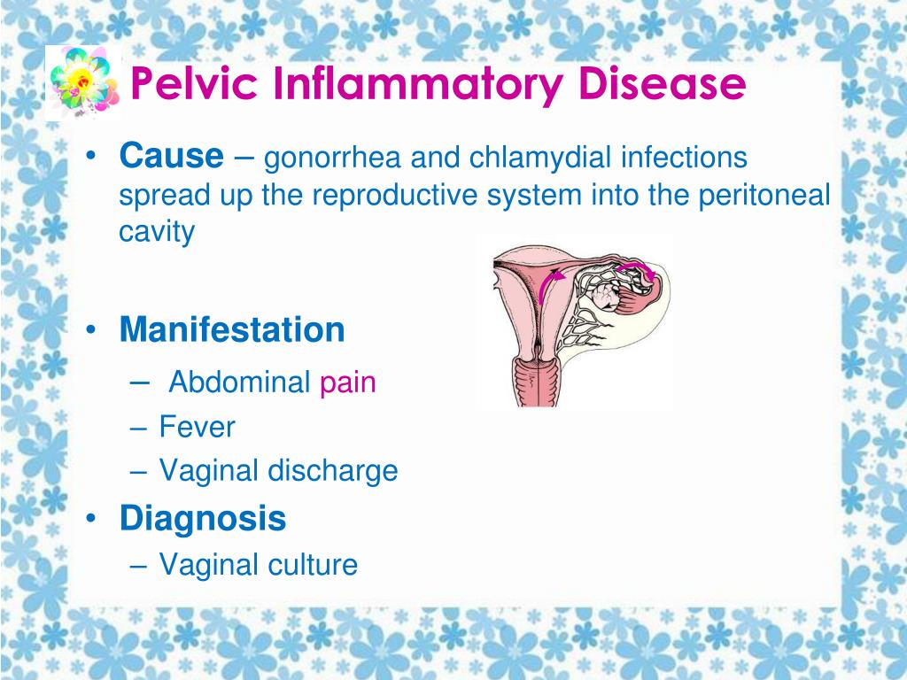 Ppt Female Reproductive Disorders Powerpoint Presentation Free