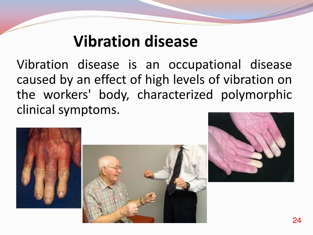 PPT - Hazardous industrial factors and their influence on human health ...