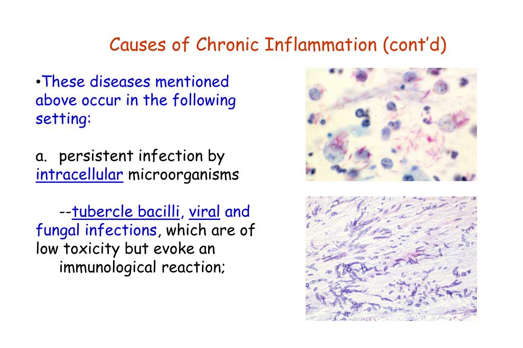 PPT - Mononuclear Leukocytes and Chronic Inflammation Wednesday ...