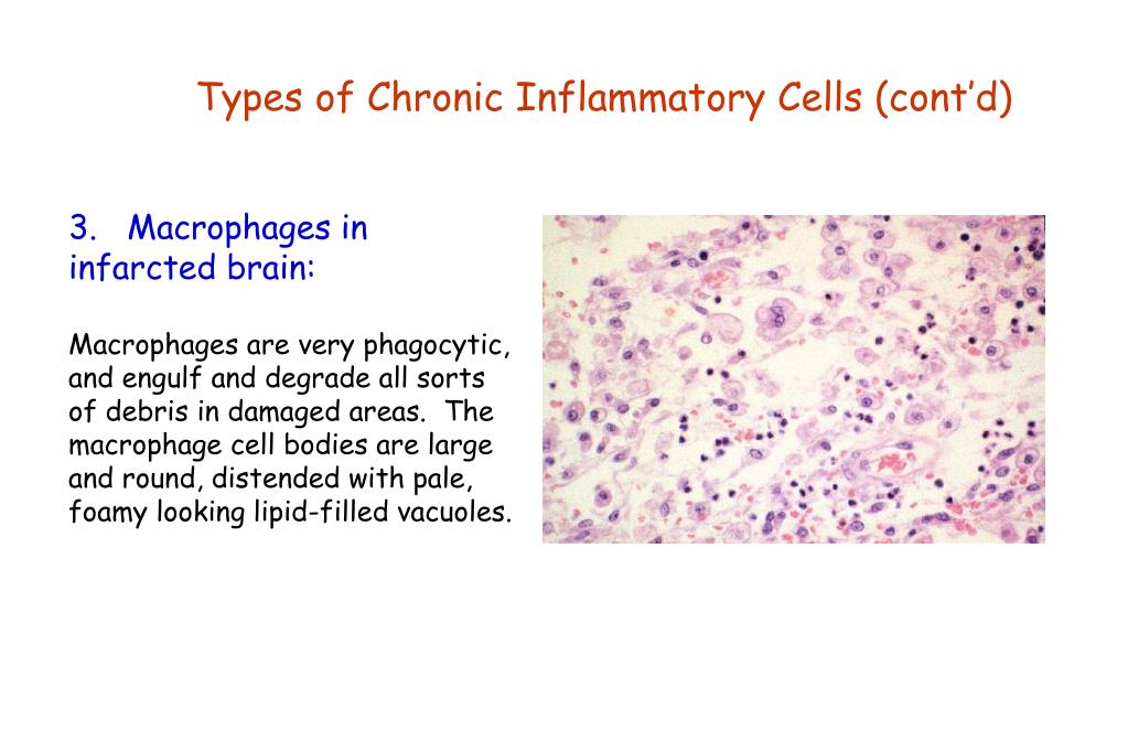 PPT - Mononuclear Leukocytes and Chronic Inflammation Wednesday ...