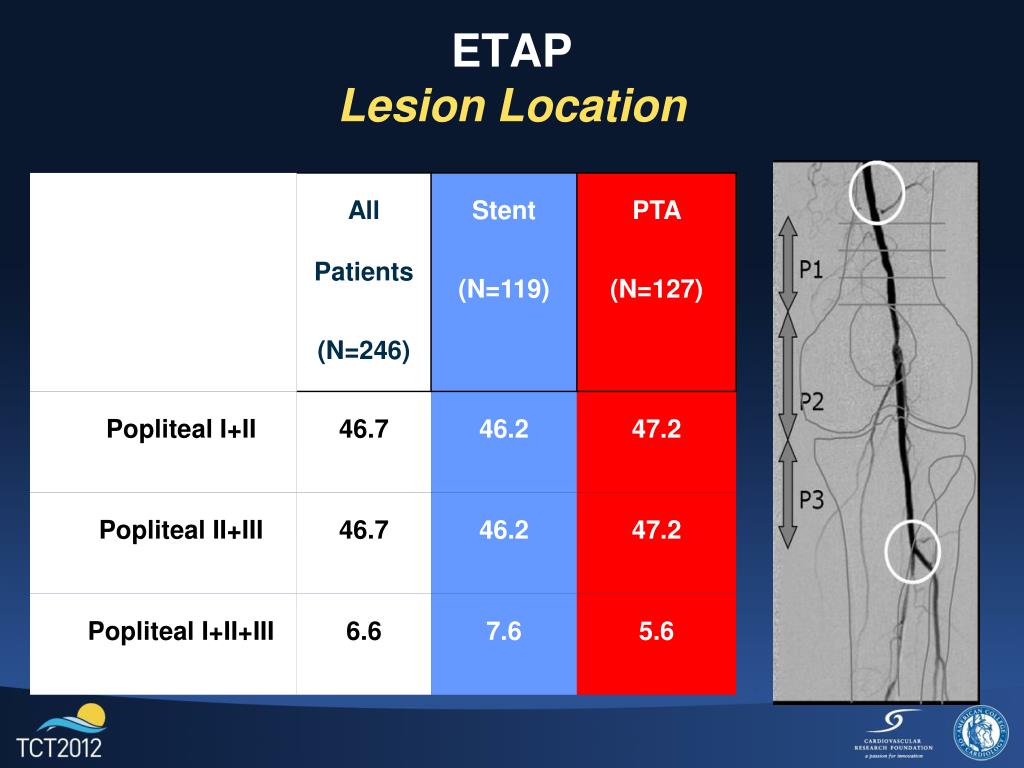 PPT - Thomas Zeller, MD Bad Krozingen, Germany On behalf of the ETAP ...