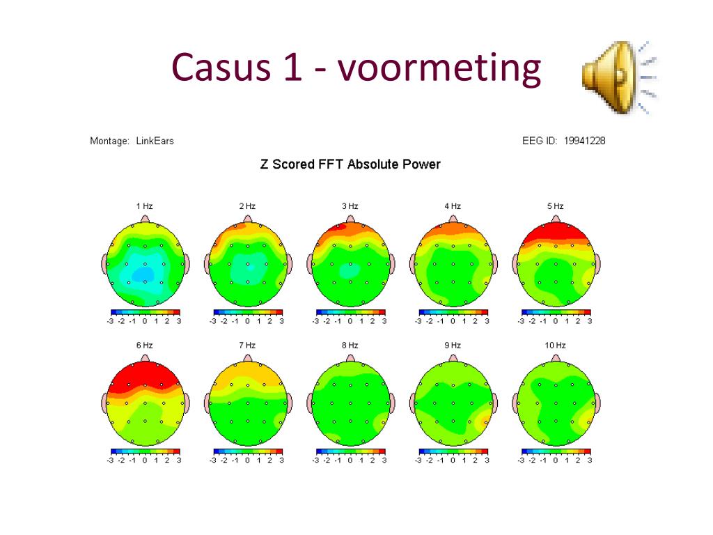 PPT - Voorbeeld PDD-NOS behandeling Klikt u op de luidspreker icoontjes ...