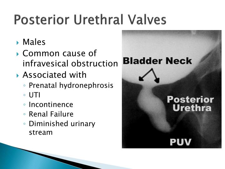 PPT - Urology Board Review PowerPoint Presentation - ID:1415071