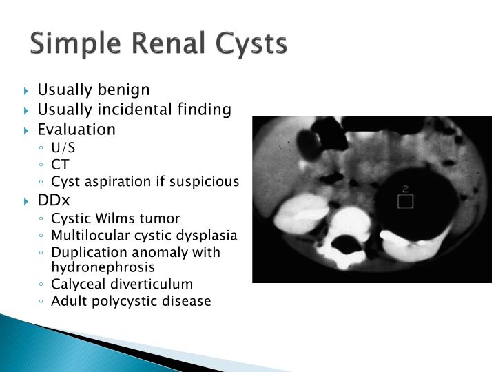 PPT - Urology Board Review PowerPoint Presentation - ID:1415071