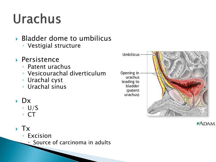 PPT - Urology Board Review PowerPoint Presentation - ID:1415071