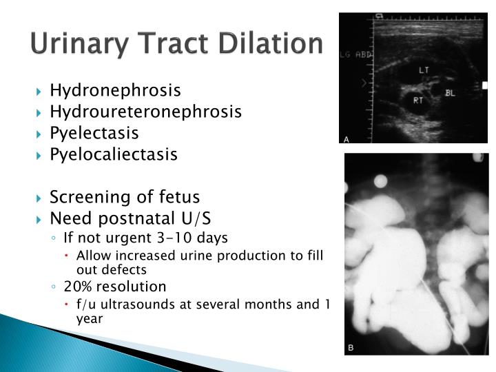 PPT - Urology Board Review PowerPoint Presentation - ID:1415071