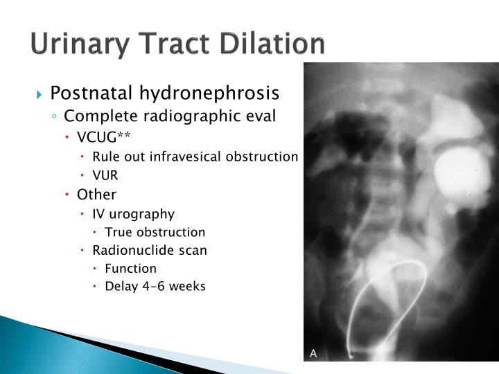 PPT - Urology Board Review PowerPoint Presentation - ID:1415071