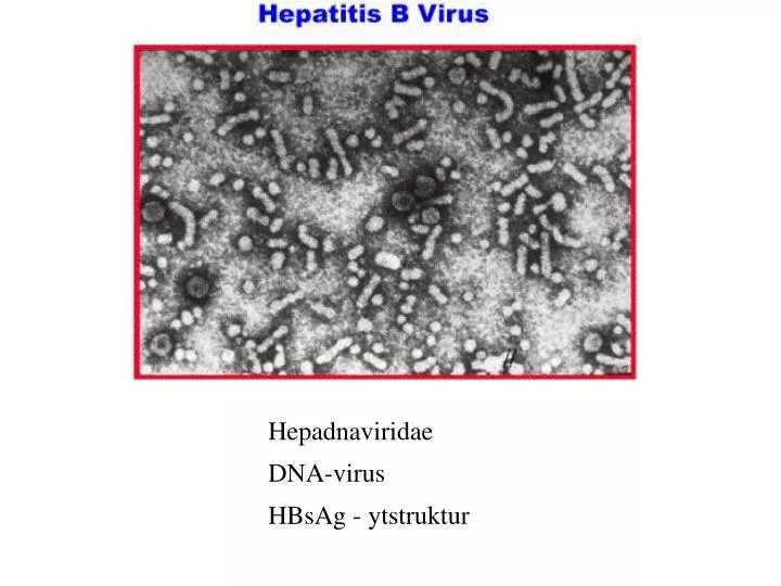 PPT - Hepadnaviridae DNA-virus HBsAg - ytstruktur PowerPoint ...