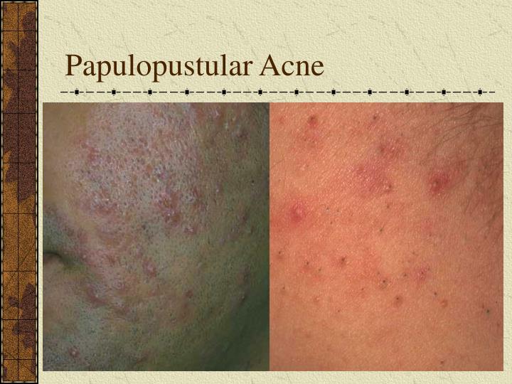 PPT - Dermatology Primer PowerPoint Presentation - ID:141906