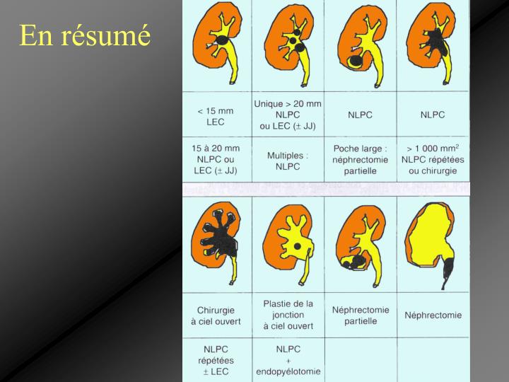 PPT - La lithiase rénale PowerPoint Presentation - ID:1419472