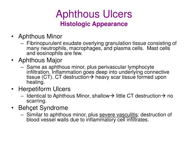 PPT - Oral Medicine Block Presentation: Aphthous Ulcers PowerPoint ...