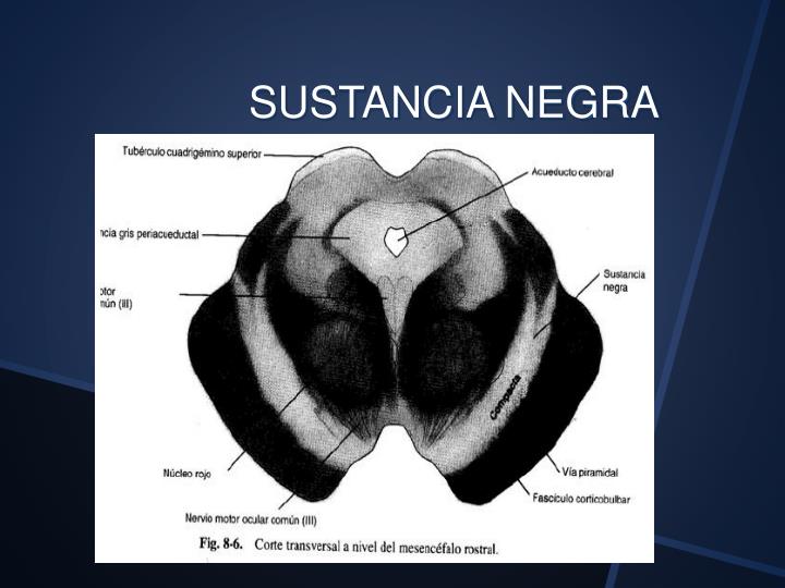 PPT - SISTEMA EXTRAPIRAMIDAL PowerPoint Presentation - ID:1420400