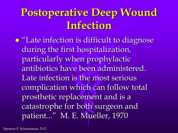 PPT - Postoperative Complications of Total Hip and Total Knee ...