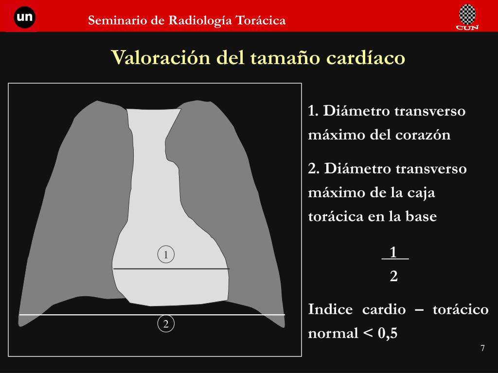 PPT - RADIOLOGIA TORACICA Seminario C.P. II PowerPoint Presentation ...