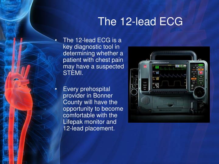 PPT - STEMI PowerPoint Presentation - ID:1423479