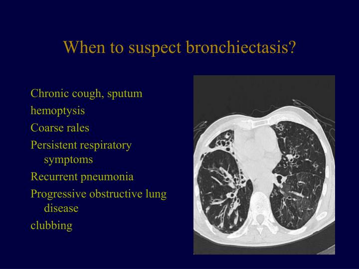 PPT - Bronchiectasis PowerPoint Presentation - ID:1426050