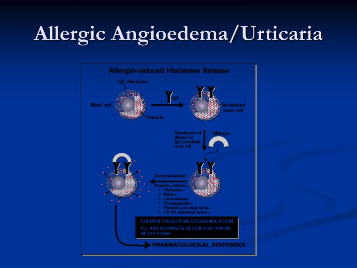 PPT - ANGIOEDEMA: Pathophysiology and Management PowerPoint ...