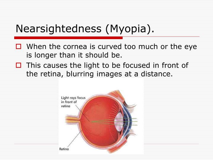 PPT - ASTIGMATISM PowerPoint Presentation - ID:1428237