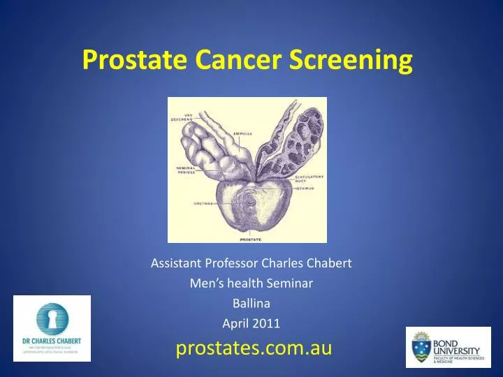 Ppt Prostate Cancer Screening Powerpoint Presentation Free Download