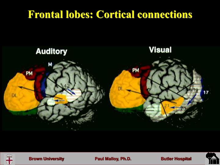 PPT - The Frontal Lobes Function and Dysfunction PowerPoint Presentation - ID:1432597